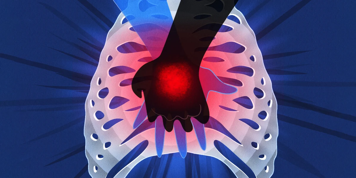 What I Learned While Practicing Compressions