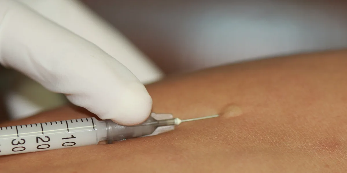 To Skin Test or Not to Skin Test?