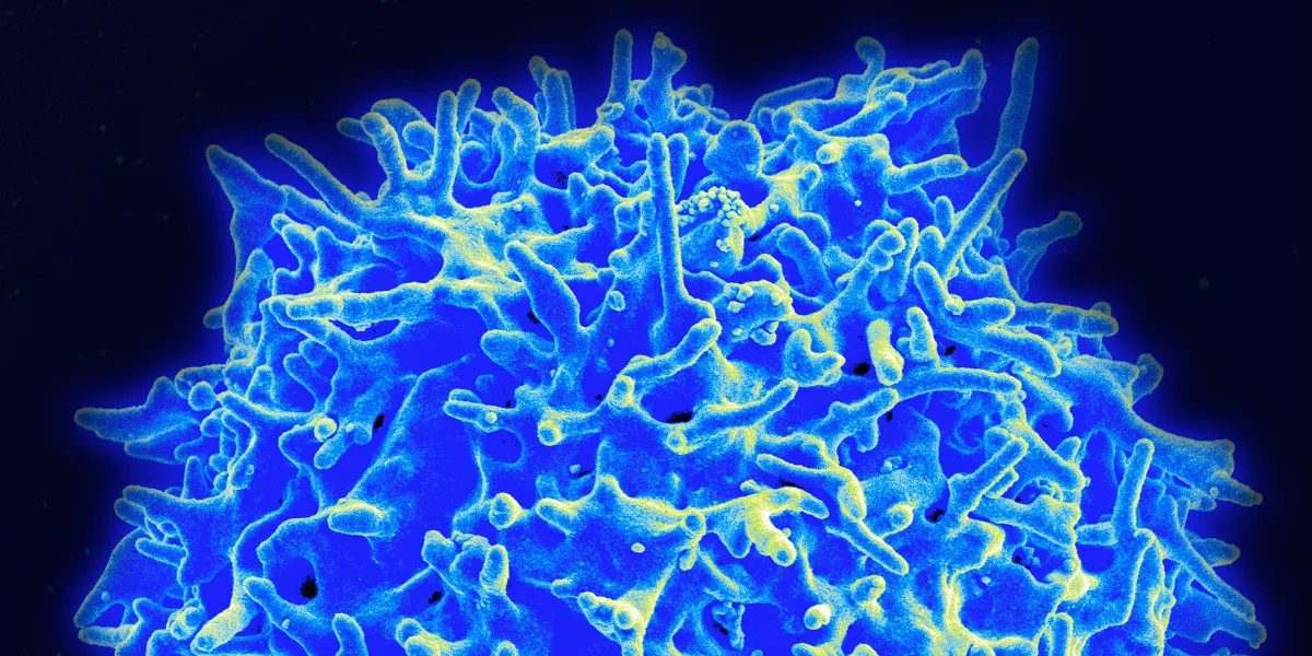 SOHO 2021: Advances in Peripheral T Cell Lymphoma (PTCL) Treatment