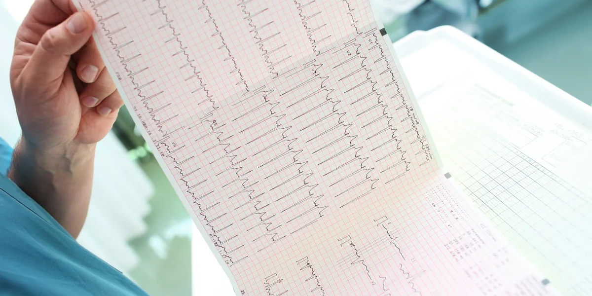 An EKG is Only as Good as the Quality of its Interpretation